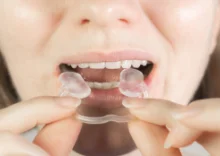 TMJ NextGeneration Device - Greencastle Dental